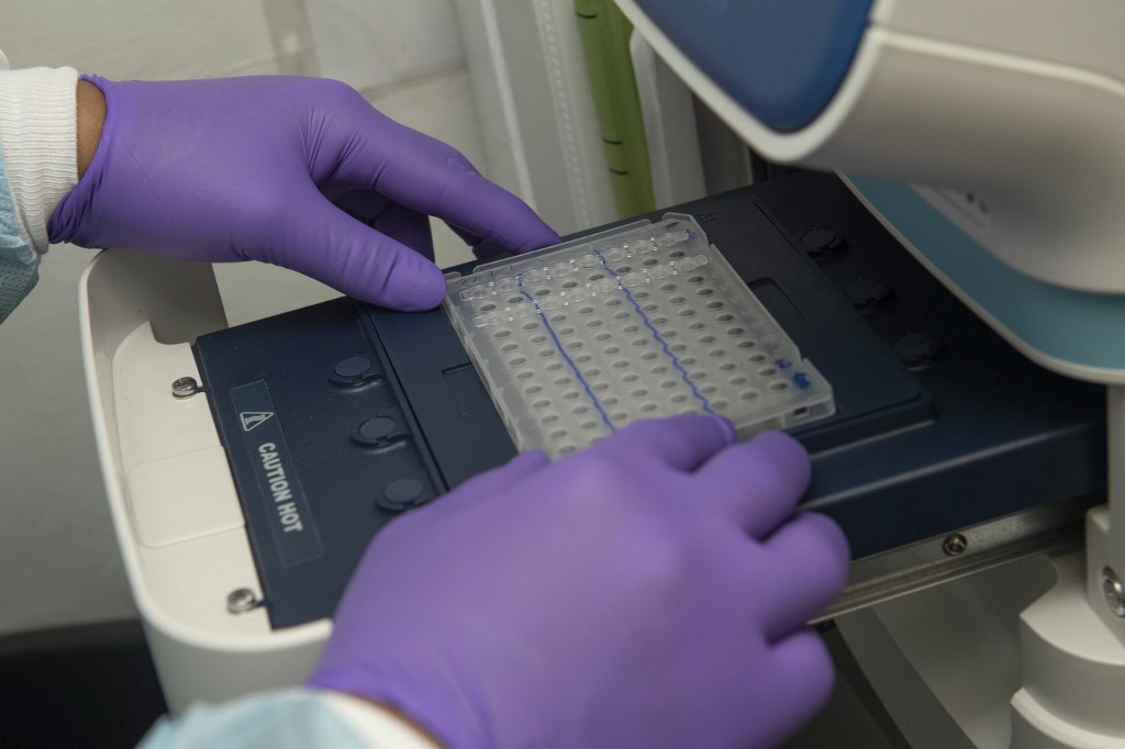 C. Sulawesi awaits COVID-19 RT-PCR test 'kits' from UK - National - The ...